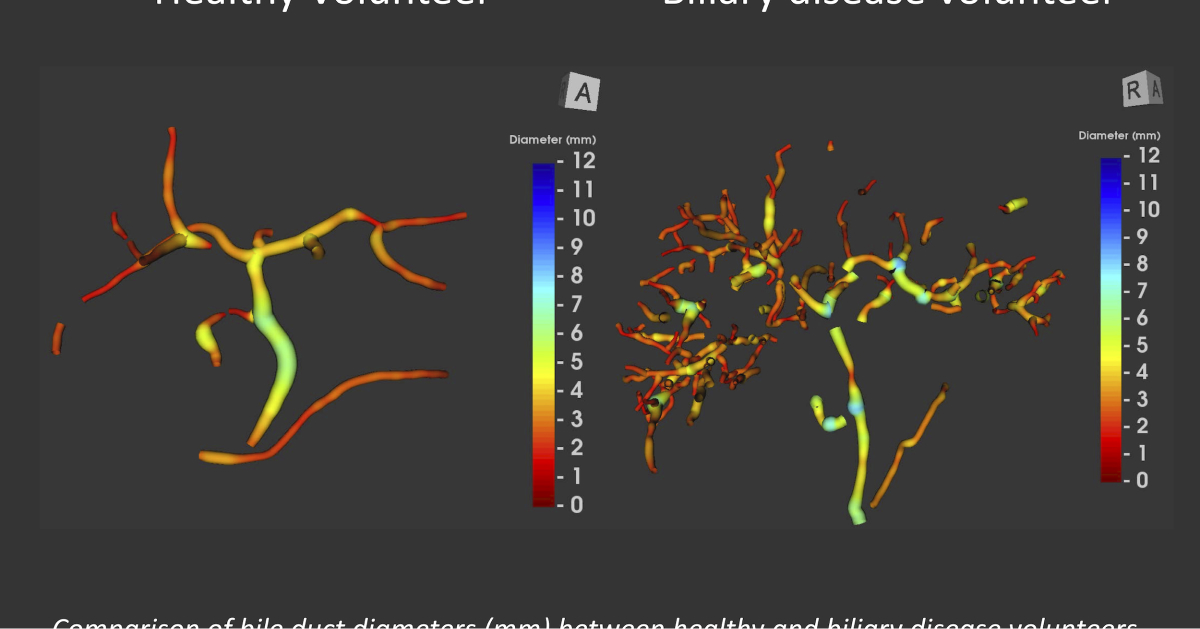 Unrivalled quantitative MRI of the biliary tree could be the next ...